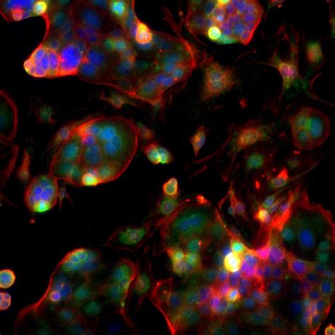 Advanced Disease Modelling Systems For Human Biology And Medicine Zayed Centre For Research