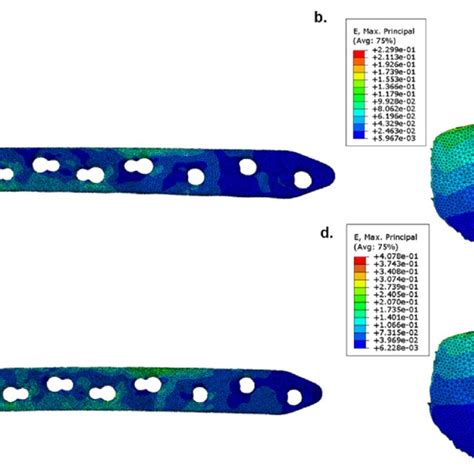 Engineering Strain Distribution In A Ti Implants And B Fracture Site Download Scientific