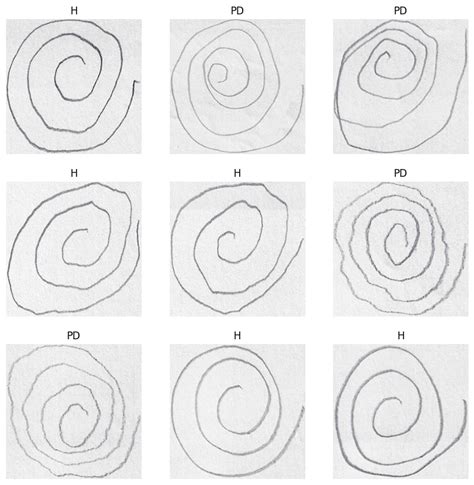 having a hard time with cnn r learnmachinelearning