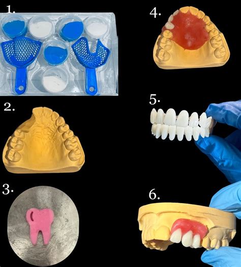Diy Denture Kit Video At John Halliburton Blog
