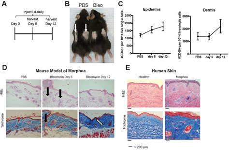 Mouse Model Inflammatory Disease At Jasmine Hodges Blog