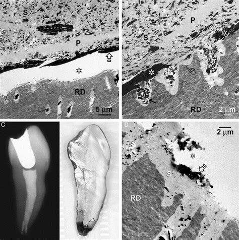 Ultrastructural Evaluation Of The Apical Seal In Roots Filled With A Polycaprolactone Based Root