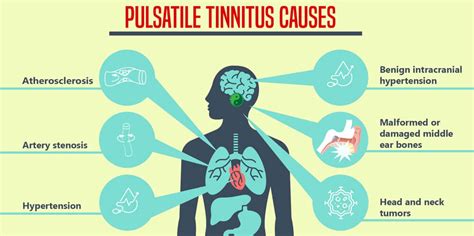Pulsatile Tinnitus Philadelphia Holistic Clinic Treatment By Dr Tsan