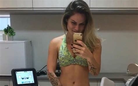 Ex Bbb Nati Casassola Posa Sem Calcinha E Fala Sobre Clareamento íntimo