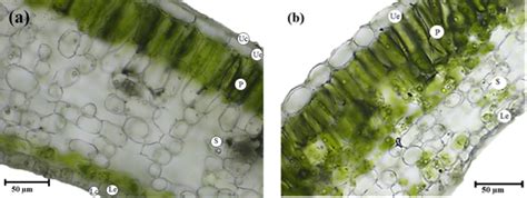 Transverse Section Through Leaf Of Vinca Major Variegata A Roof