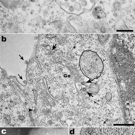 Transmission Electron Microscopy Of Sars Cov 2 Variant Rj1 Pre Egress Download Scientific
