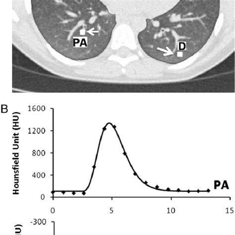 Dynamic Timeattenuation Curve Data For An Sni Subject Graphs Show Download Scientific Diagram
