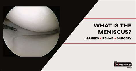 What is a Meniscus Injury Learn About Meniscus Surgery Rehab 𝗣 𝗥𝗲𝗵𝗮𝗯