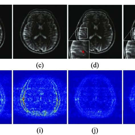 Performance Of Algorithms Under Cartesian Undersampling Scheme At 35 Download Scientific