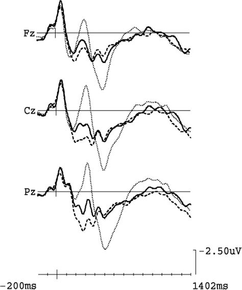 Grand Average Erp Waveforms For Control Participants N 20 Recorded At
