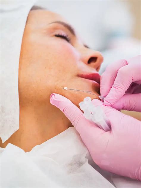 Sugar Threads Lift In Memphis Pdo Non Surgical Facelift