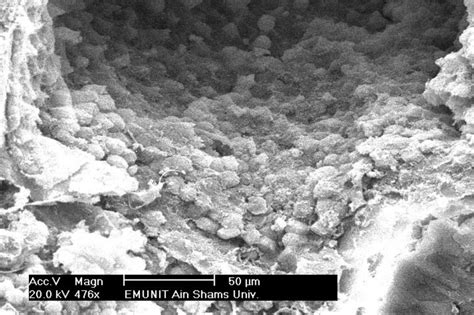 Scanning Electron Micrograph Of The Testicular Sections From Group Iii
