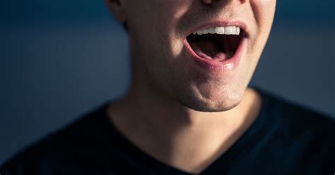 Stuttering Gwas Highlights Sex Specific Genetic Risk Parallels With