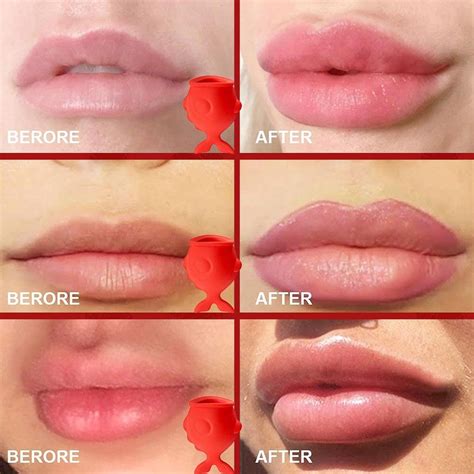 Buy Jomeworld Lip Pump Silicone Lip Filler For Natural Long Lasting