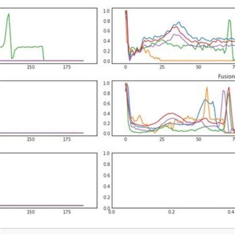 PDF A Model For Electrocardiogram ECG Classification Using Convolutional Neural Network CNN