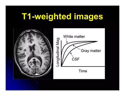 Dwi Adc Mri Principles In Veterinary Medicine Pdf