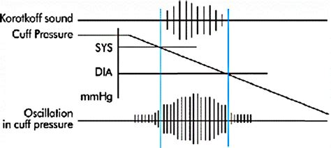 Oscillation Amplitudes Observed With The Oscillometric Method