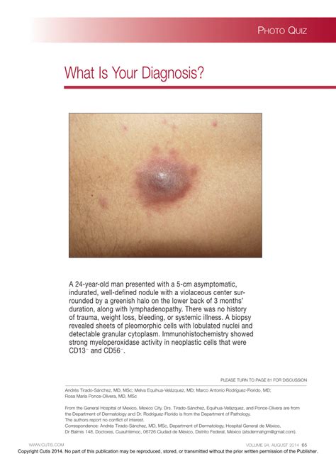 Pdf What Is Your Diagnosis Granulocytic Sarcoma