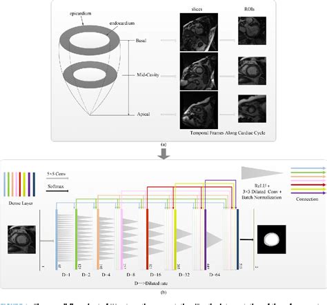 Figure 1 From Left Ventricle Segmentation Based On A Dilated Dense Convolutional Networks