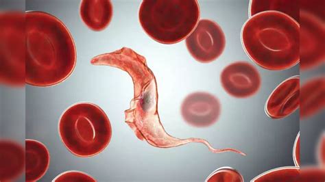 Us Faces Rise In Skin Disfiguring Infection Causing Hard To Heal Sores