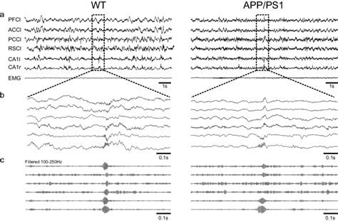 Representative Example Of Co Occurring Ripple Like Oscillations Download Scientific Diagram