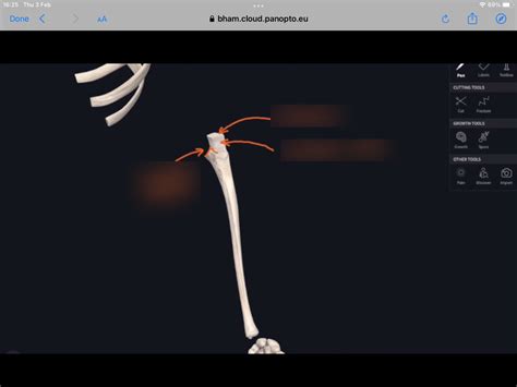 Diagram Of Mjm Week 2 Ulna Quizlet