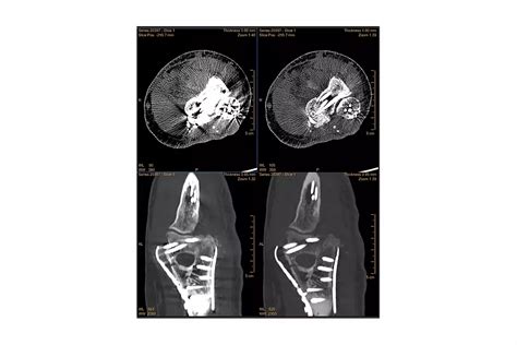 Philips Iqon Spectral Ct Circular Edition