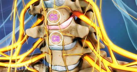 Pin On Medical