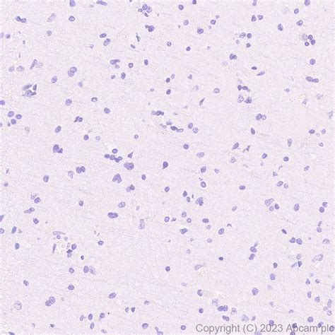 Anti Streptococcus Mutans Cell Surface Antigen I Ii Antibody [epr28235 11] Ab316006 Abcam