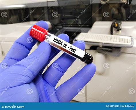 Homa Ir Stands For Homeostatic Model Assessment Of Insulin Resistance