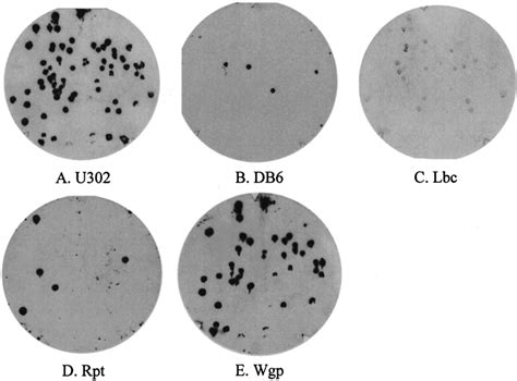 Colony Hybridization Of Mixed Cultures Of Five Lab Using Specific Download Scientific Diagram