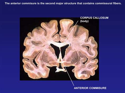 Physiology Of Cerebral Cortex Cerbral Cortexppt Physiology Of Cerebral Cortex Cerbral Cortexppt