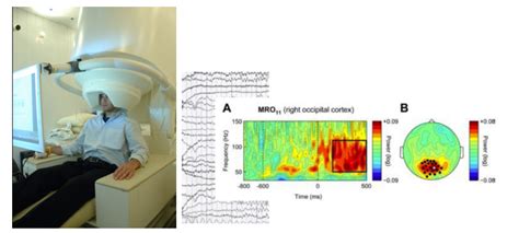 机器学习 脑电硬件丨人类如何观测大脑？脑成像技术概览（上） 好未来技术团队 Segmentfault 思否