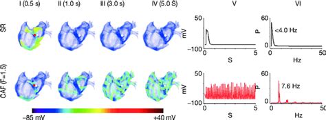 Simulation Of Spiral Waves In 3d Virtual Human Atrium Top Panels Show Download Scientific