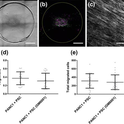 Quantification Of Collagen Fiber Alignment And Total Cells Migrated Download Scientific Diagram
