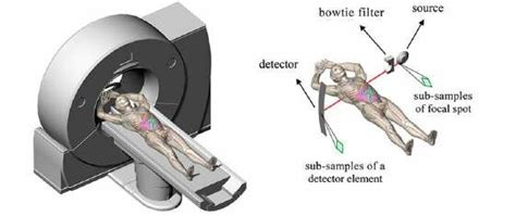 Shown On The Left Is What The CT Scanner Looks Like On The Outside Download Scientific Diagram
