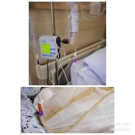 The Filipino Interventional Radiologist Home Facebook