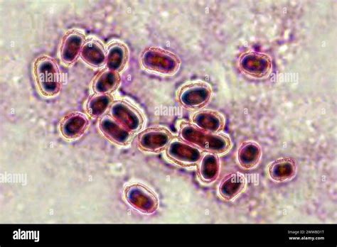 Pneumococcus Streptococcus Pneumoniae Pneumococcus Is A Bacteria