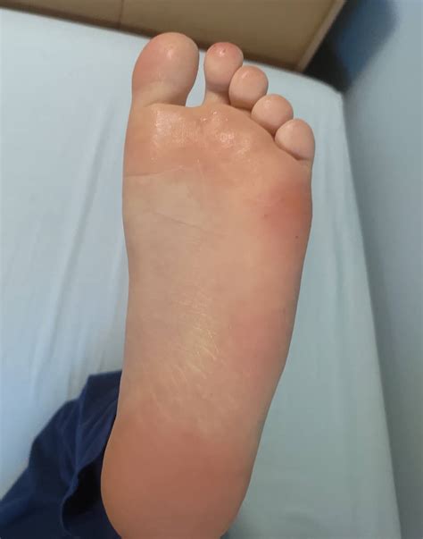 Sweaty Sole After Run By Azusa Tepes On Deviantart
