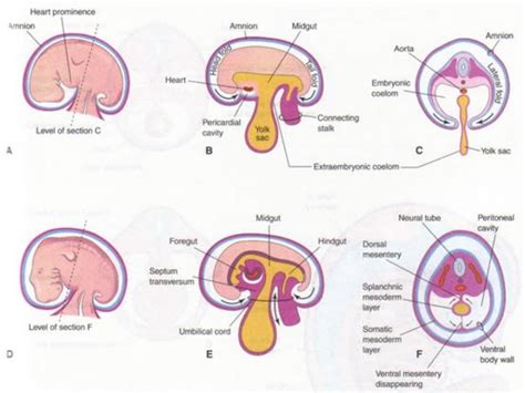 Abdominal Wall Defects