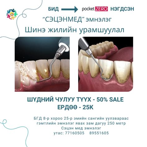 СЭЦЭН МЕД Шүдний эмчийн үзлэг зөвлөгөө эмчилгээ шинэ