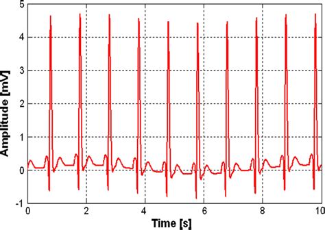 time evolution of 10 periods of ecg with minor baseline wander
