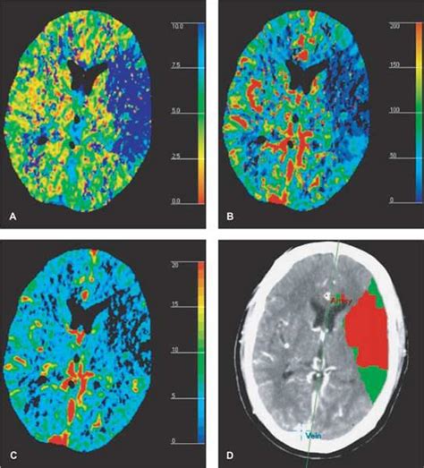 CONCEPTS OF COMPUTED TOMOGRAPHY Radiology Key