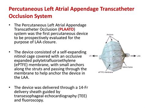 Left Atrial Appendage Closure Pptx