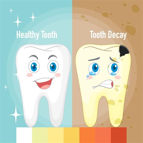 Infographic Of Healthy Tooth And Tooth Decay 6591376 Vector Art At Vecteezy
