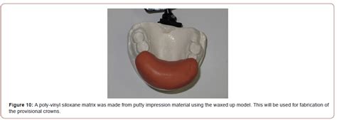redefining a smile with monolithic cad cam crowns a step by step