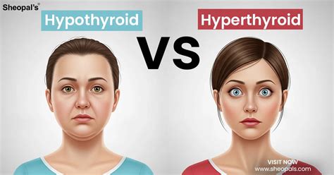 Hypothyroid Vs Hyperthyroid Causes Symptoms And Whats The Differenc Sheopals