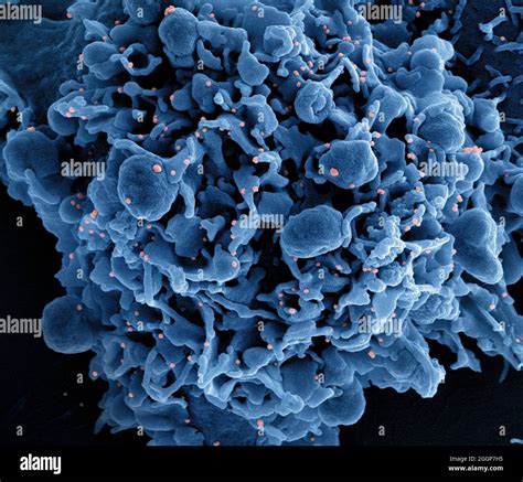 Colorized Scanning Electron Micrograph Of A Cell Blue Infected With Sars Cov 2 Virus Particles