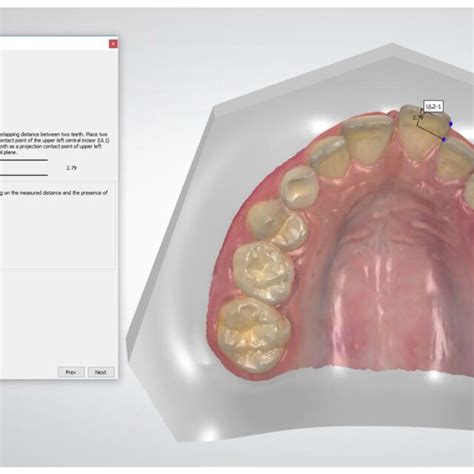 Peer Assessment Rating Par Index Scoring Using Ortho Analyzer Download Scientific Diagram