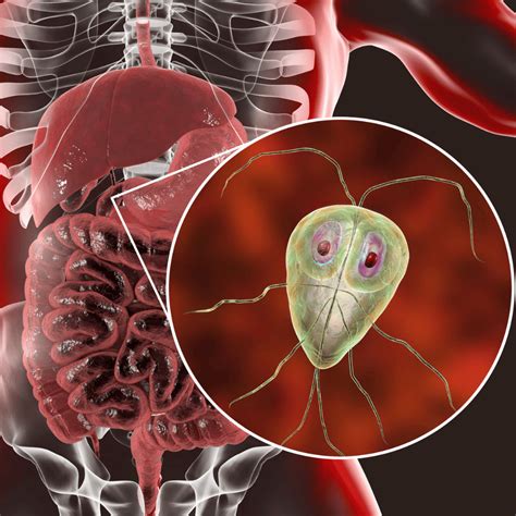 Giardia Lifecycle Symptoms And Treatments Parasite Free Me